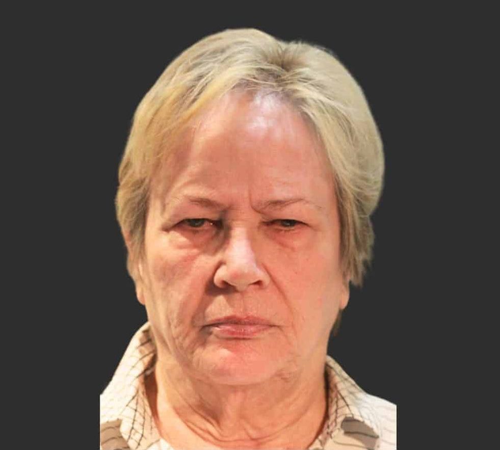 Lower Blepharoplasty - TOC Eye and Face